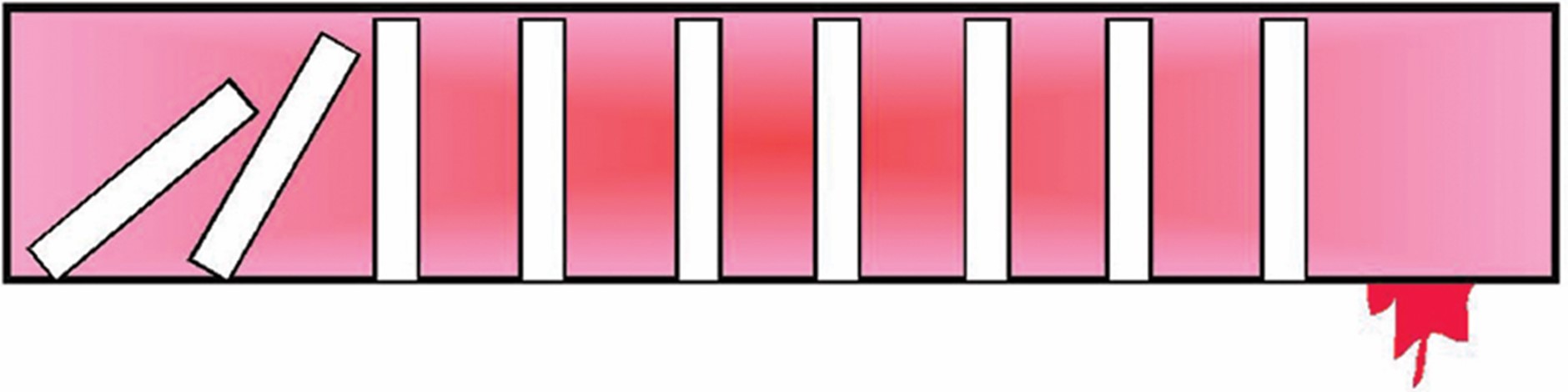 Haemophilia - Irish Haemophilia Society